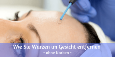 Warzenarten: Übersicht, Merkmale & Behandlungsmöglichkeiten